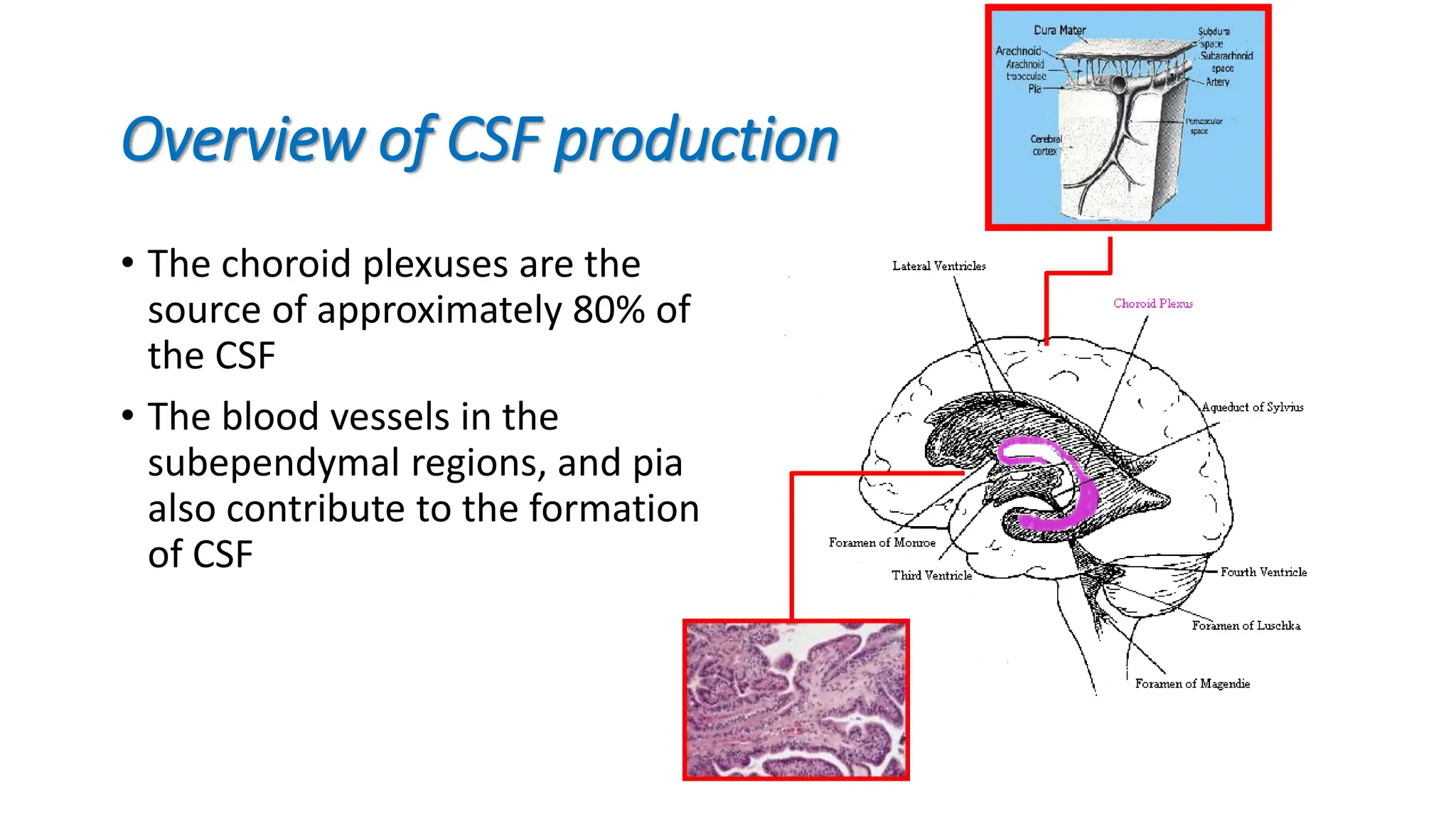 Hydrocephalus and Other Disorders of CSF Circulation.pptx
