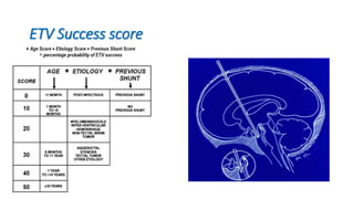 Hydrocephalus and Other Disorders of CSF Circulation.pptx