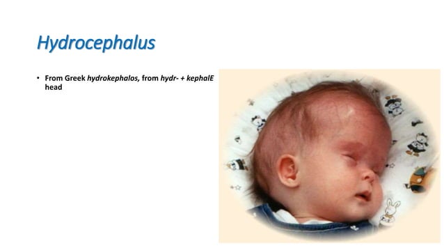 Hydrocephalus and Other Disorders of CSF Circulation.pptx
