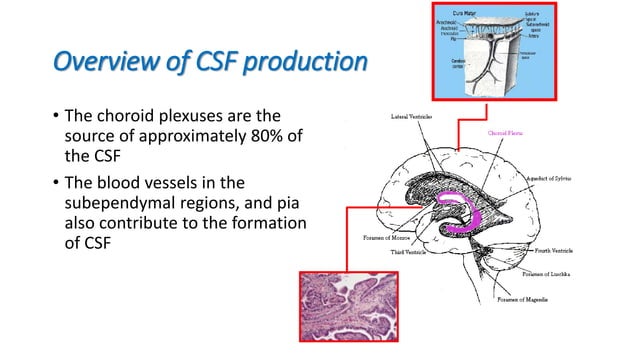 Hydrocephalus and Other Disorders of CSF Circulation.pptx
