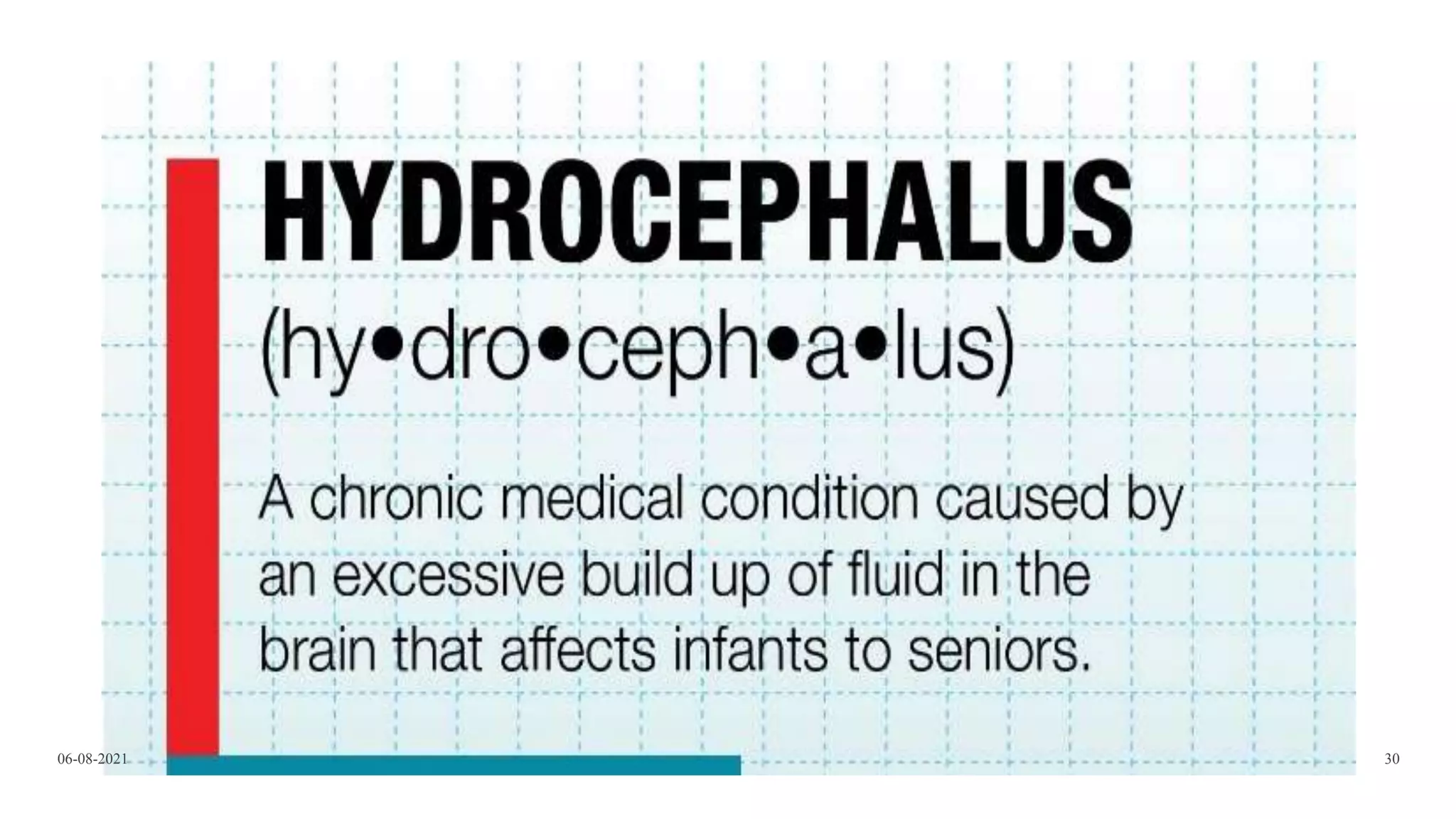 Hydrocephalus | PPTX | Brain and Nervous System Disorders | Diseases and Conditions