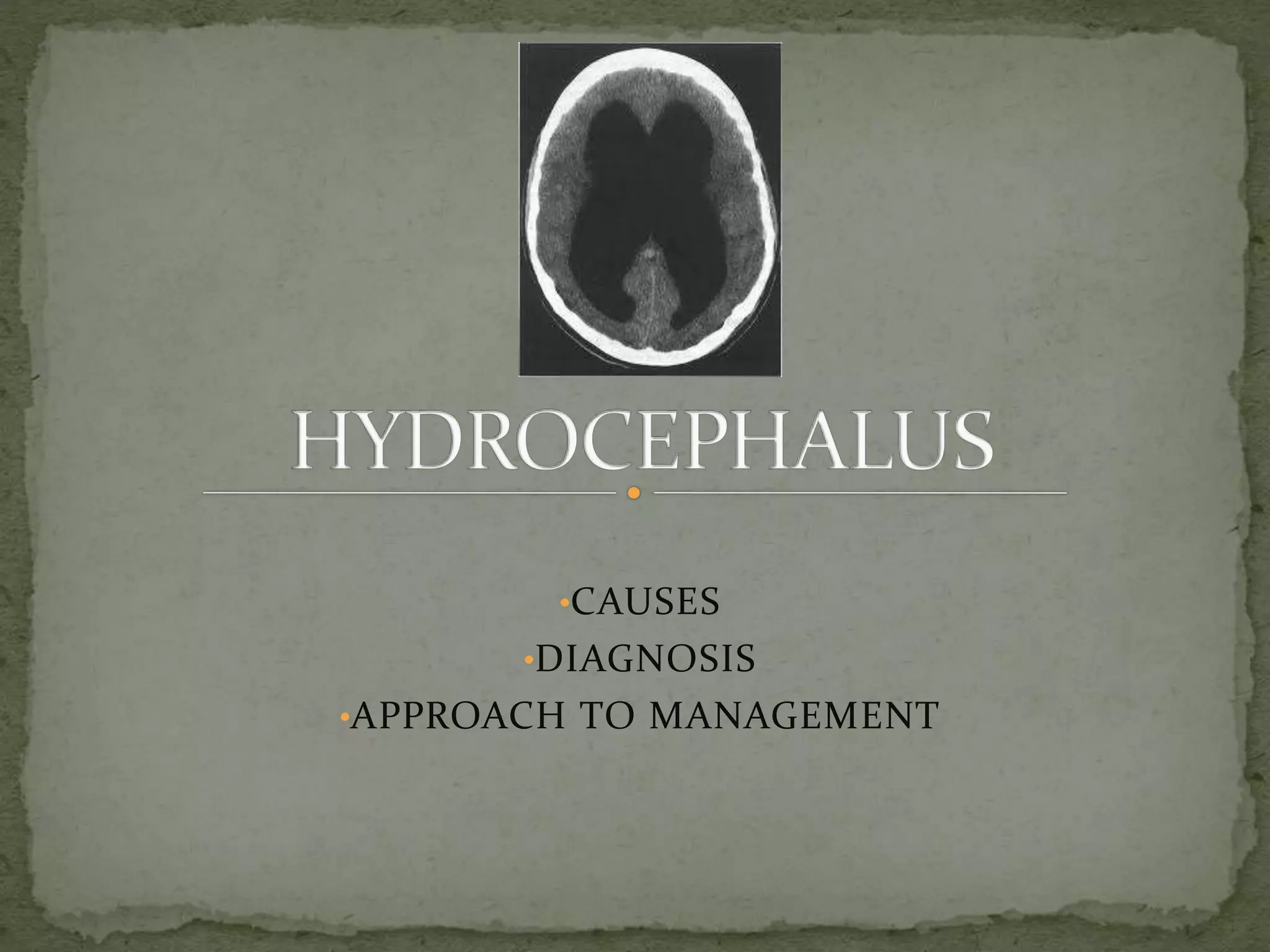 Hydrocephalus - Dr Sameep Koshti (Consultant Neurosurgeon) | PPTX
