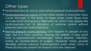 Hydrocephalus | PPT