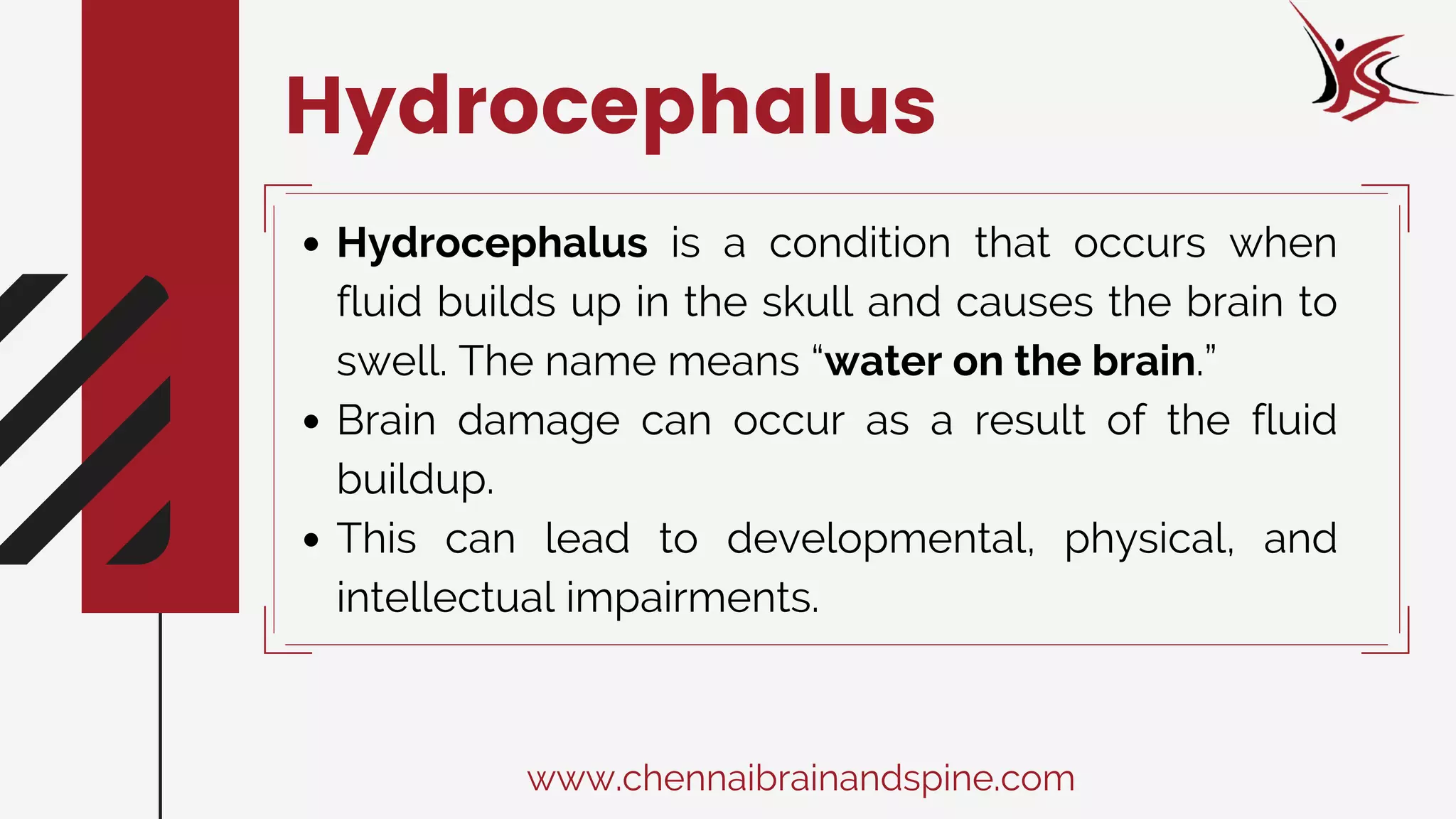 Hydrocephalus in adults and children | PDF
