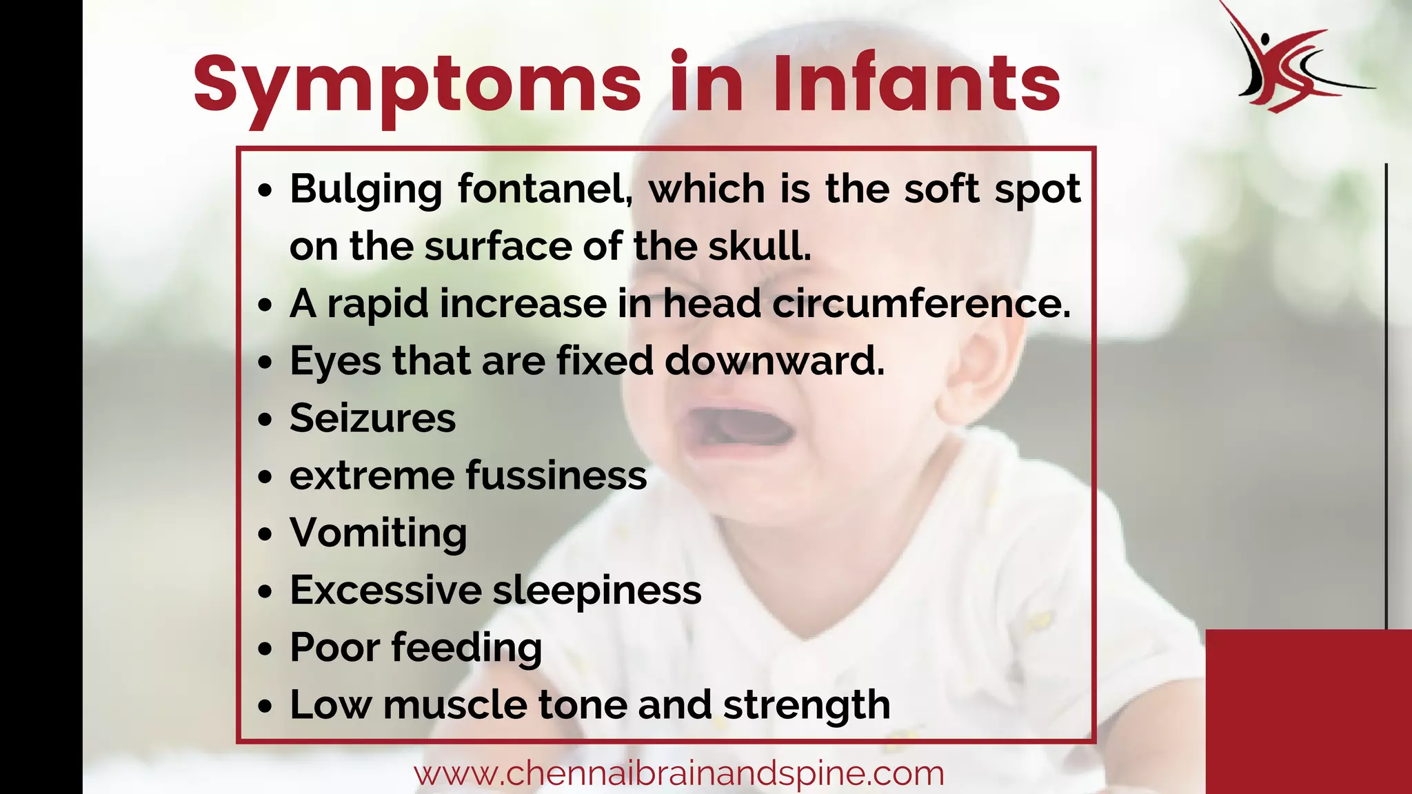 Hydrocephalus in adults and children | PDF