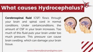 Hydrocephalus in adults and children | PDF | Brain and Nervous System Disorders | Diseases and ...