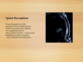 Hydrocephalus Lecture Atul.ppt