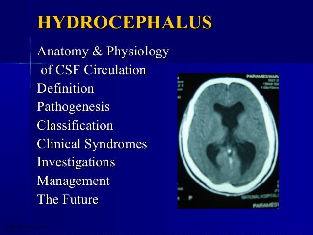 Hydrocephalus.Dr NG NeuroEdu