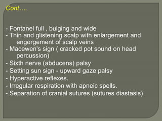 Hydrocephalus | PPTX