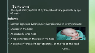 Hydrocephalus presentation | PPTX