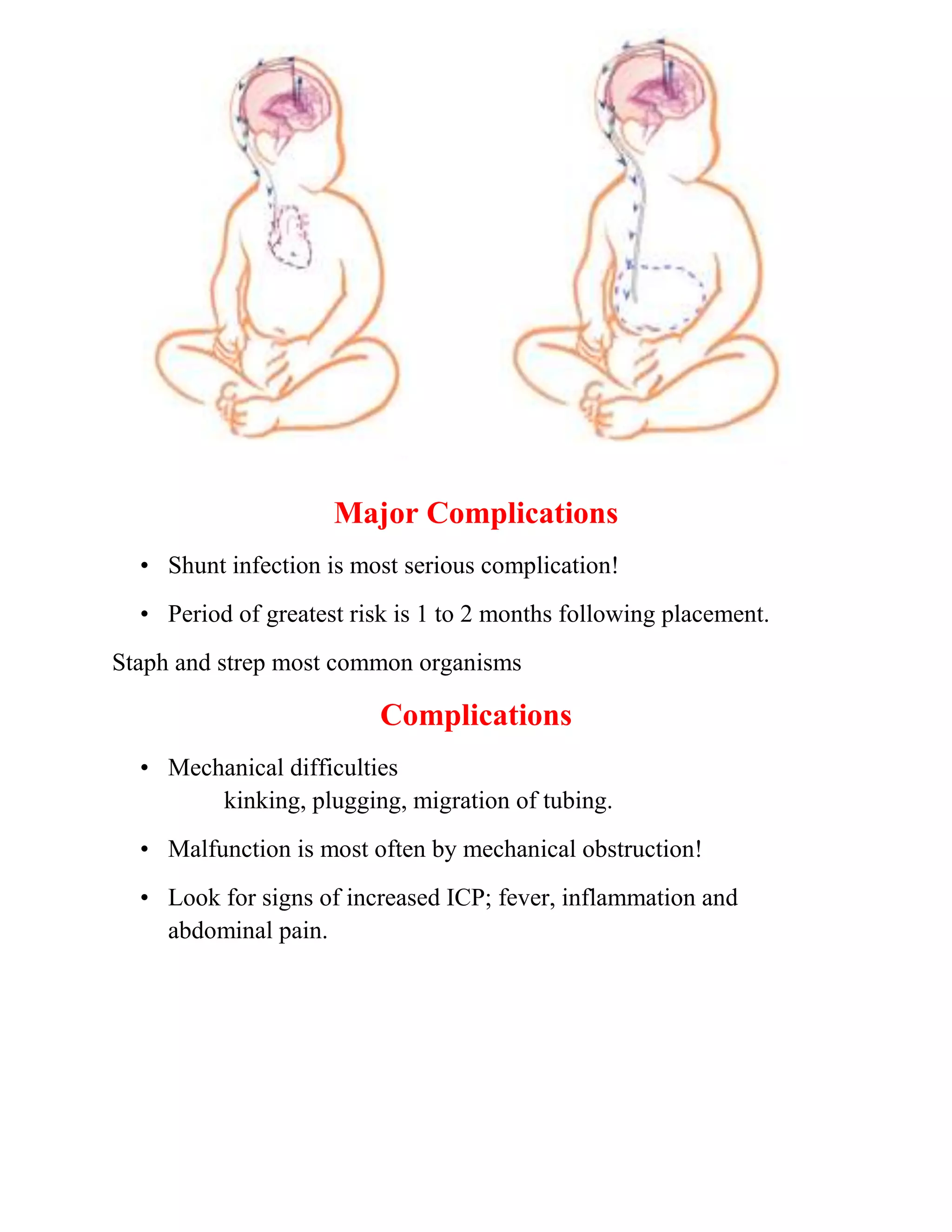 HYDROCEPHALUS presentation.docx