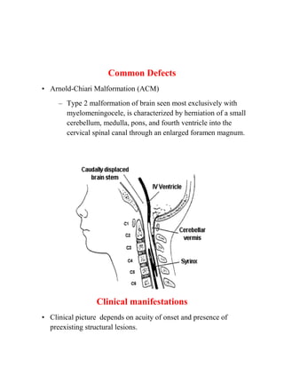 HYDROCEPHALUS presentation.docx