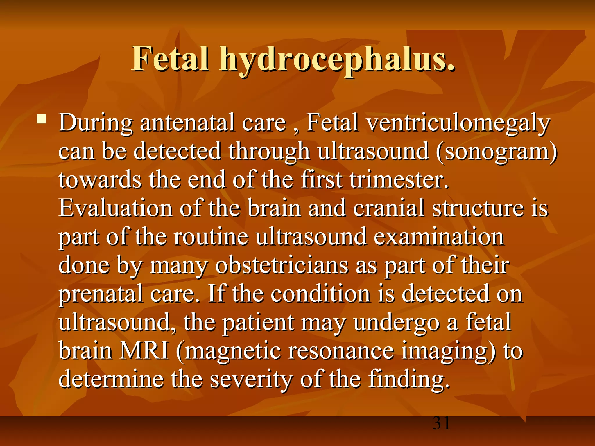 Hydrocephalus project | PPT