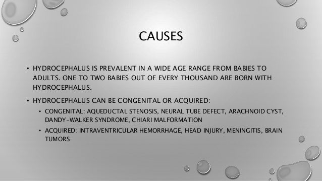 Scars Shunt Hydrocephalus Hydrocephalus And Shunts: Sean's Story
