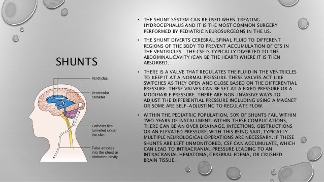 Hydrocephalus shunts