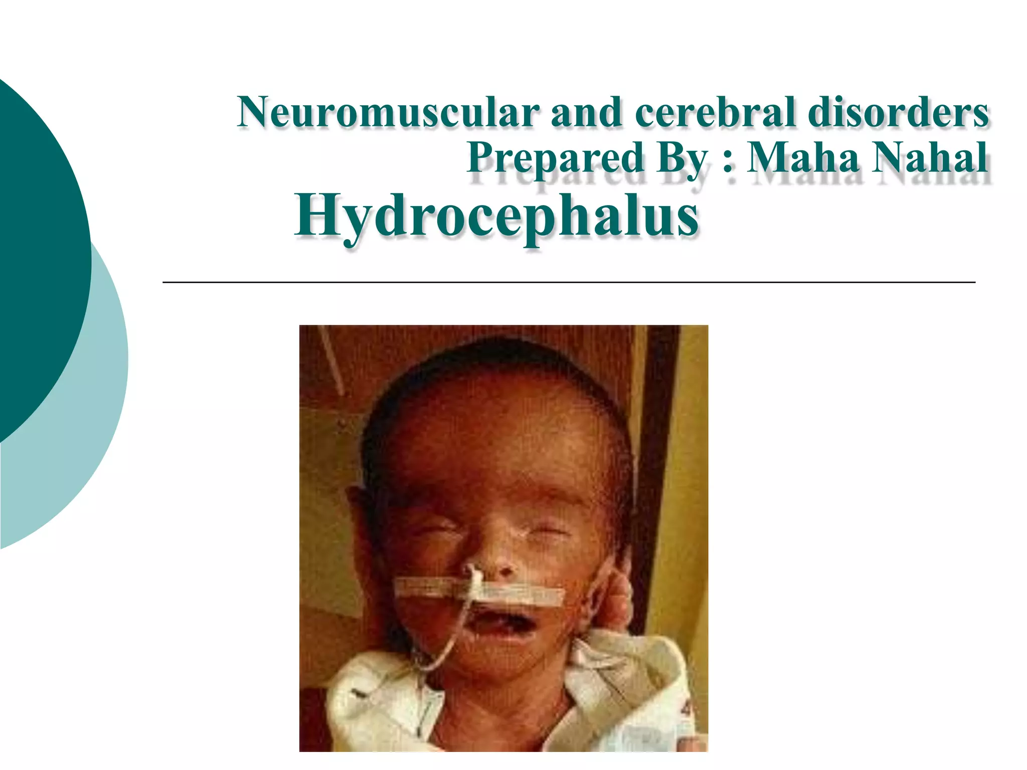hydroceph and spina bifida.pptx