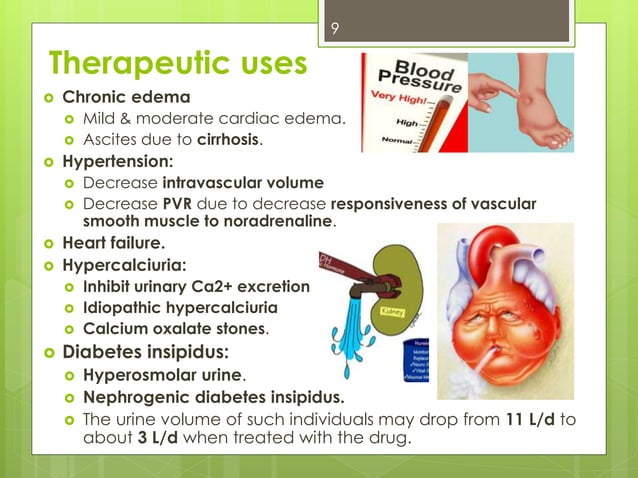 Hydrochlorothiazide | PPTX