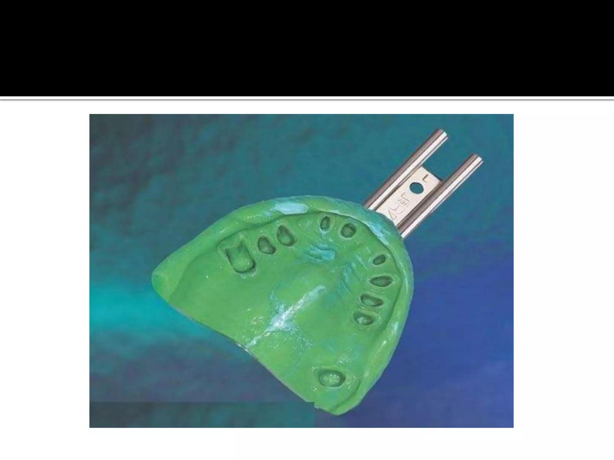 Hydrocolloid impression materials | PPTX