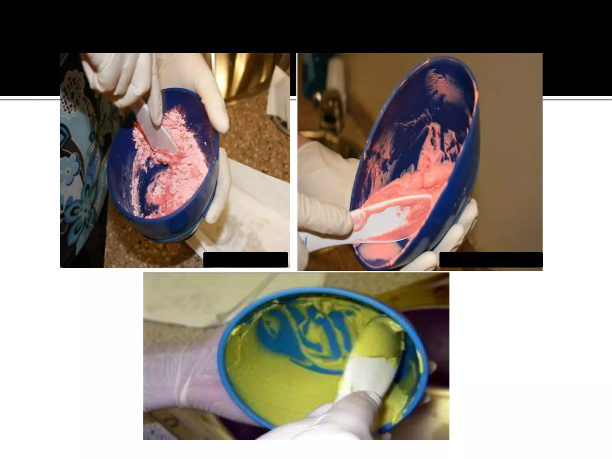 Hydrocolloid impression materials | PPTX