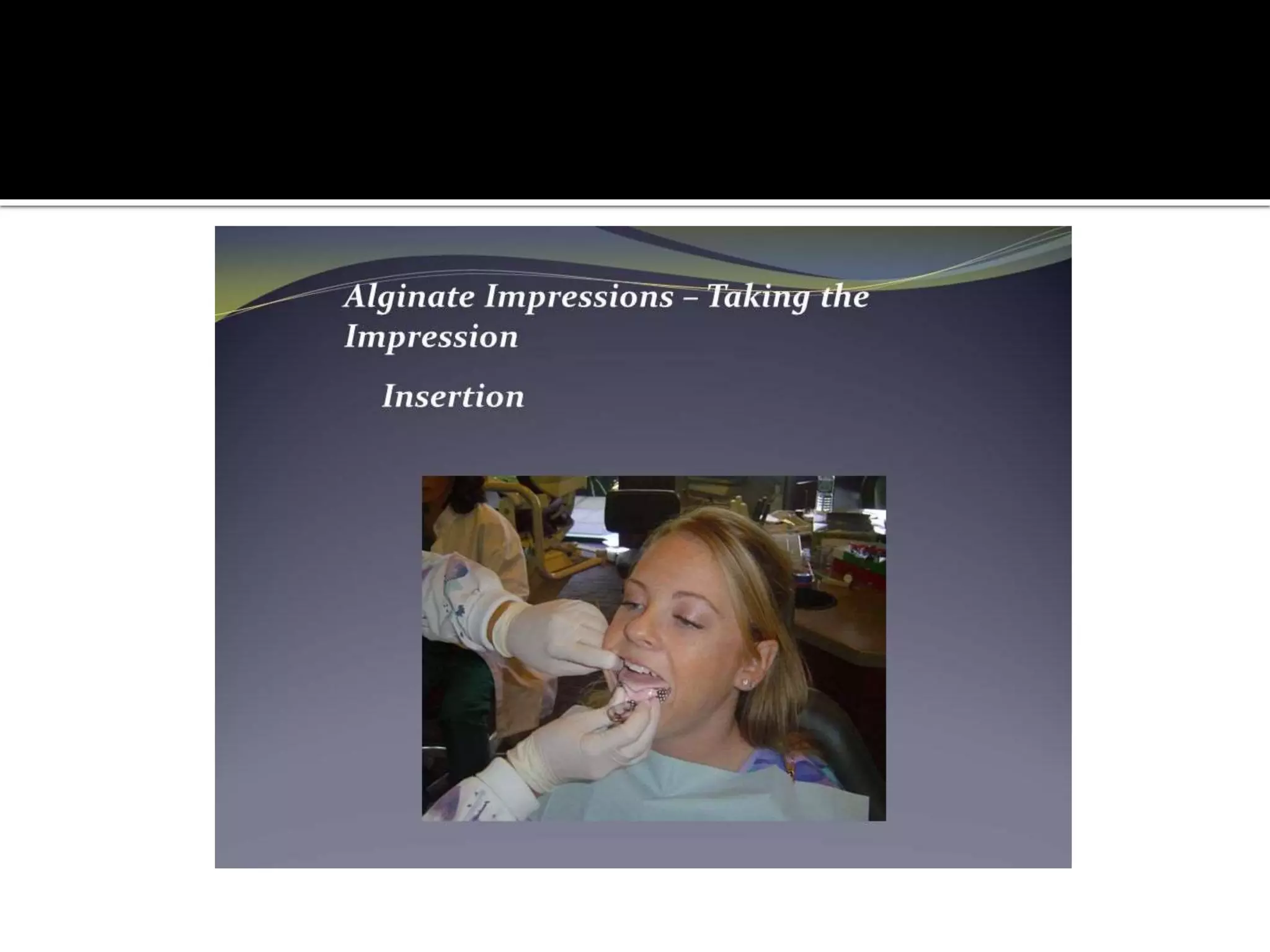 Hydrocolloid impression materials | PPTX