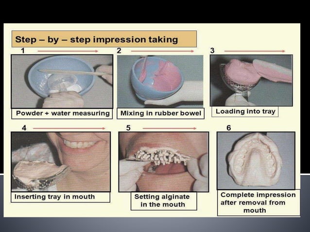 Hydrocolloid impression materials | PPTX | Oral care | Personal Care