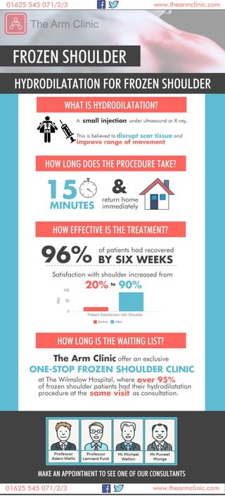 Hydrodilatation for Frozen Shoulder | PDF