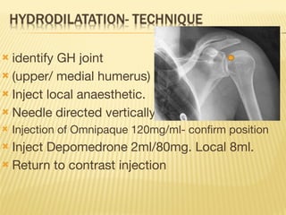 Hydrodilatation distension for frozen shoulder wrightington 2011 | PDF