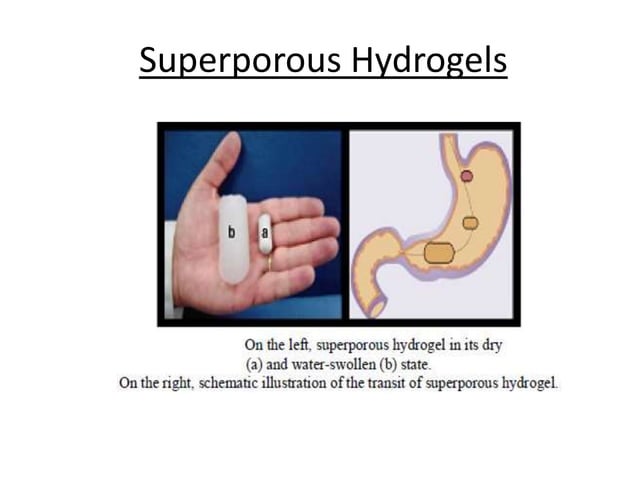 Hydrodynamically balanced systems | PPTX | Digestive Disorders ...