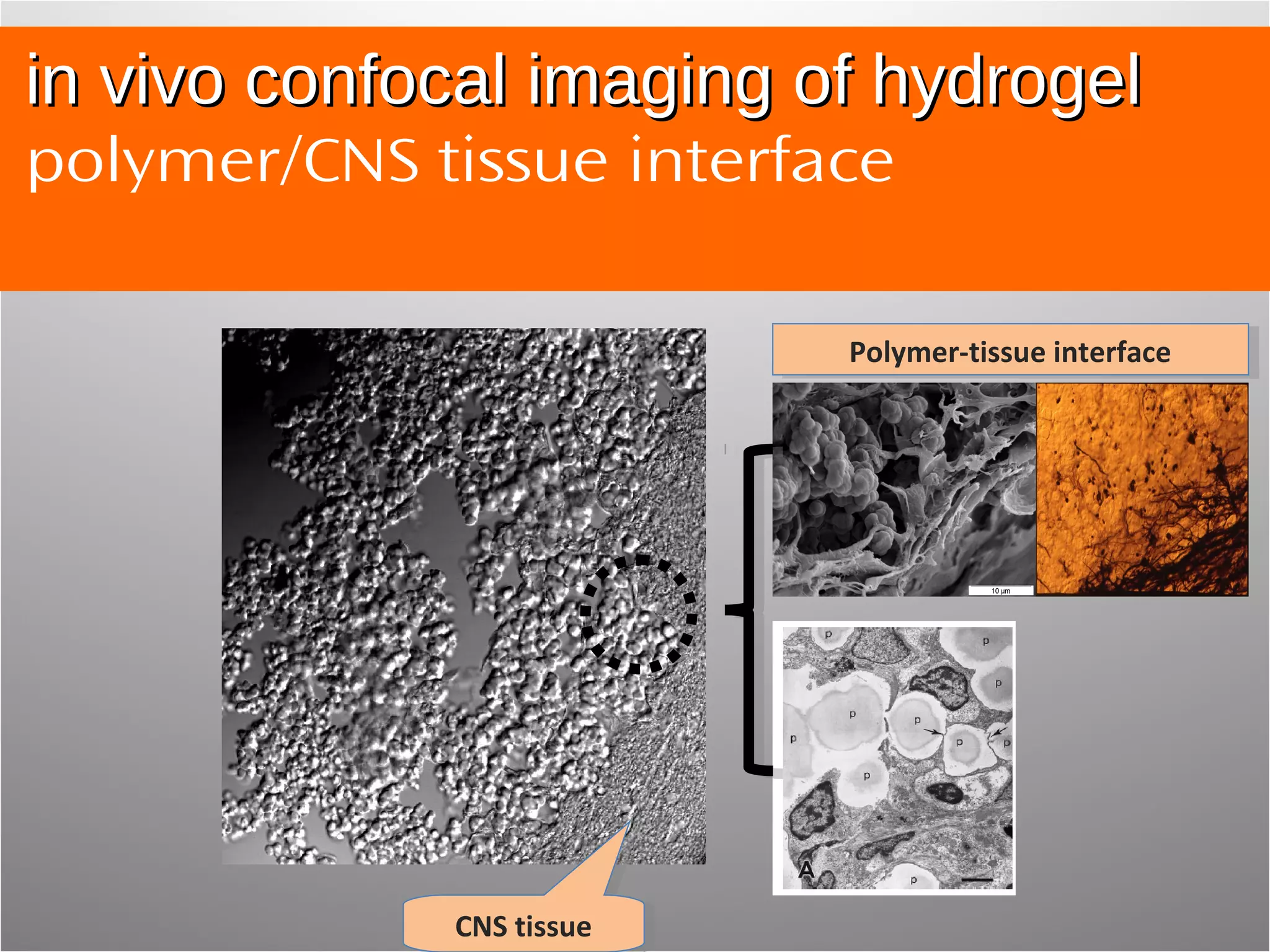 Hydrogel Technology | PPT