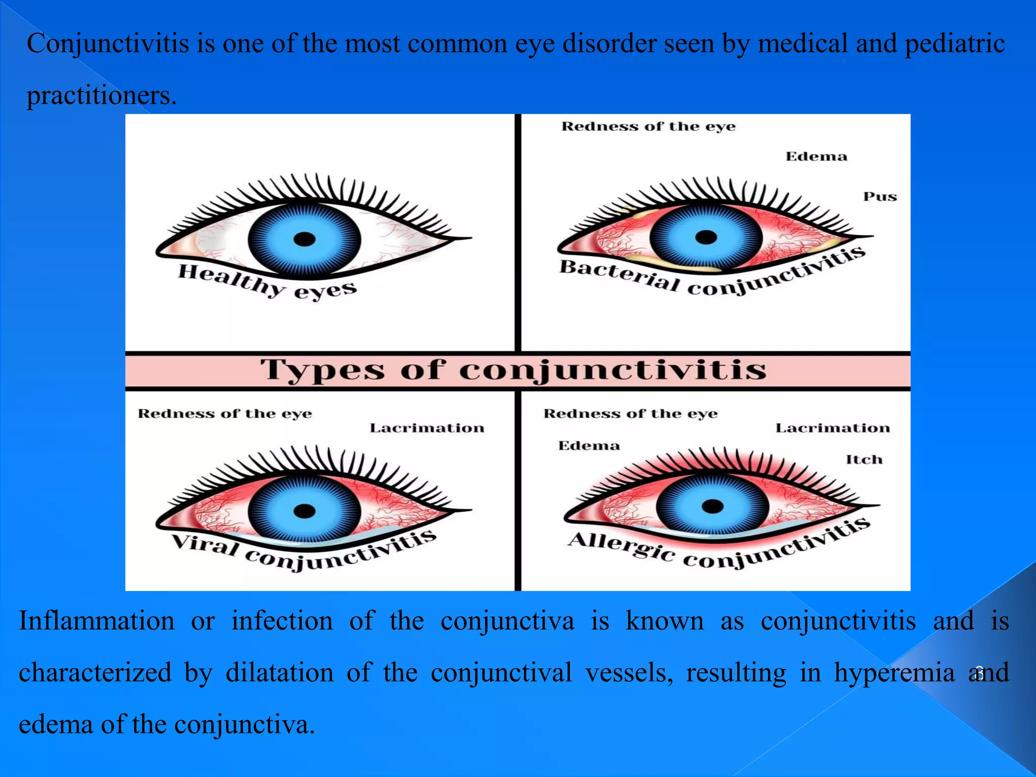 Research Based Presentation on- Novel Hydrogel-Based Ocular Drug ...