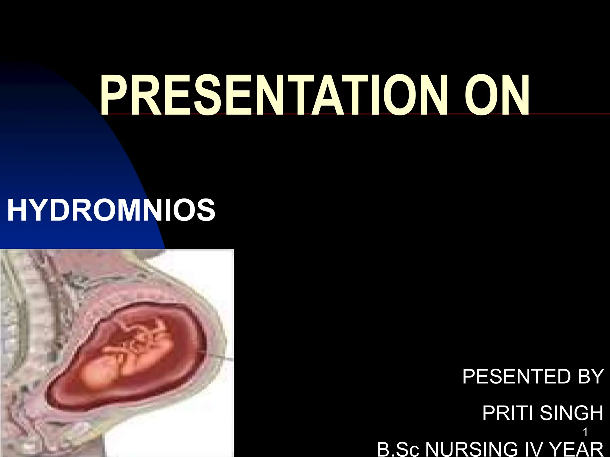 HYDROMNIOS in pregnancy in management of hydromnias | PPT