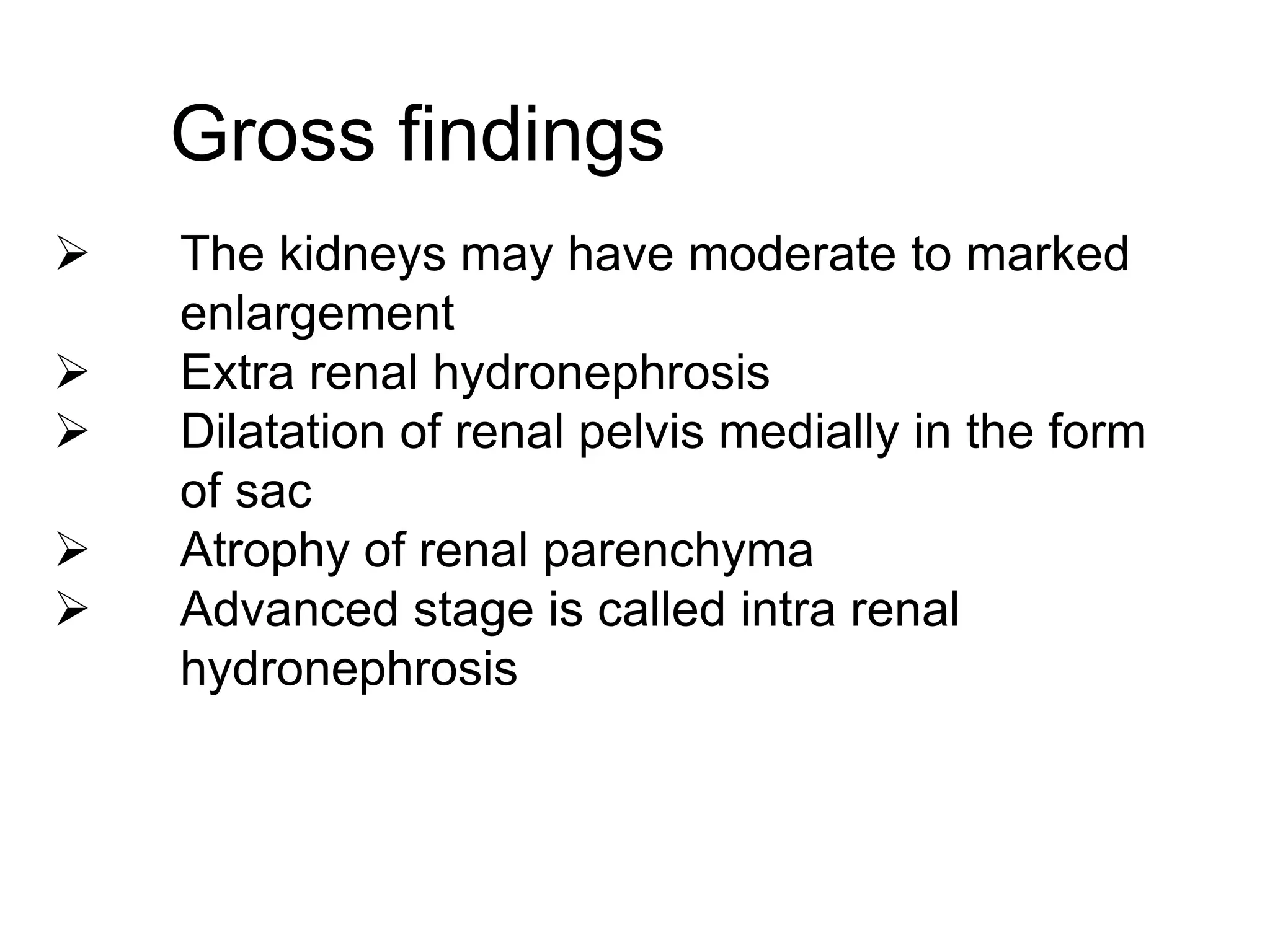 Hydronephrosis | PPTX