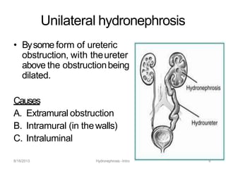 Hydronephrosis | PPTX