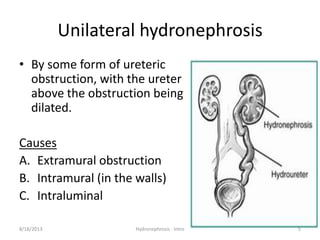 Hydronephrosis - Intro | PPTX