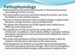 Hydronephrosis | PPTX