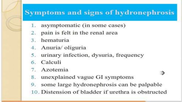Hydronephrosis | PPTX