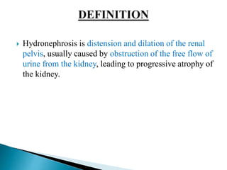 Hydronephrosis | PPT