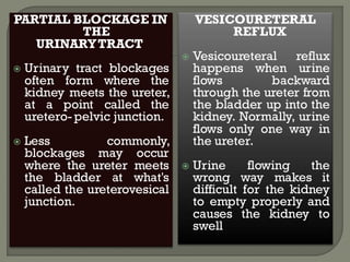 Hydronephrosis | PDF