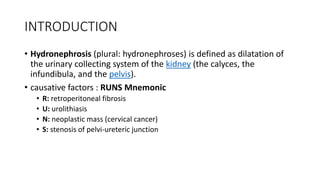 HYDRONEPHROSIS.pptx