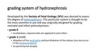 HYDRONEPHROSIS.pptx