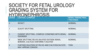 hydronephrosis.pptx