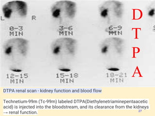 hydronephrosis-221122055345-ef1e2953.pptx