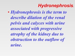 Hydronephrosis.pptx
