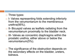 hydronephrosis.pptx