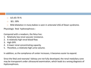 hydronephrosis.pptx