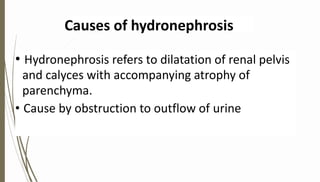 hydronephrosis.pptx