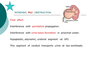 HYDRONEPHROSIS.pdf antenatal paediatric | PDF