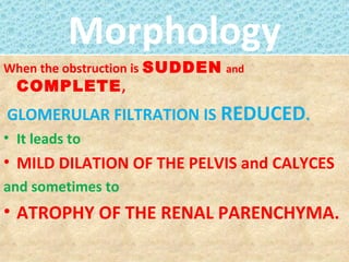 Hydronephrosis for students | PPT