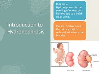 Hydronephrosis disease presentation for nurse | PPT