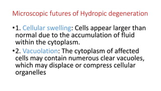 hydropic degenaration.pptx